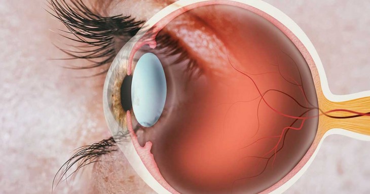 La kératite - Actualités - Sante-dz